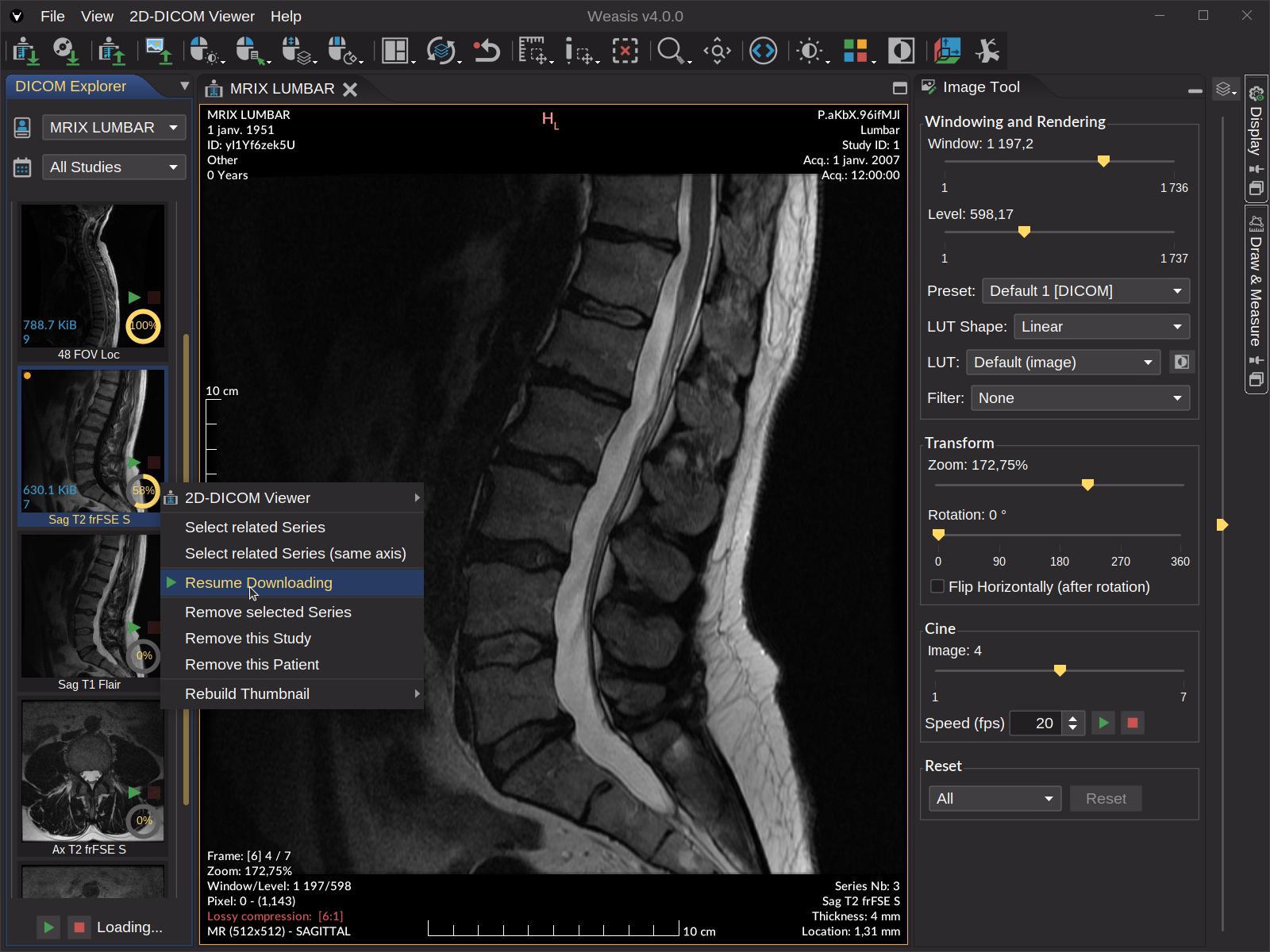 Weasis: Free DICOM viewer :: Weasis Documentation